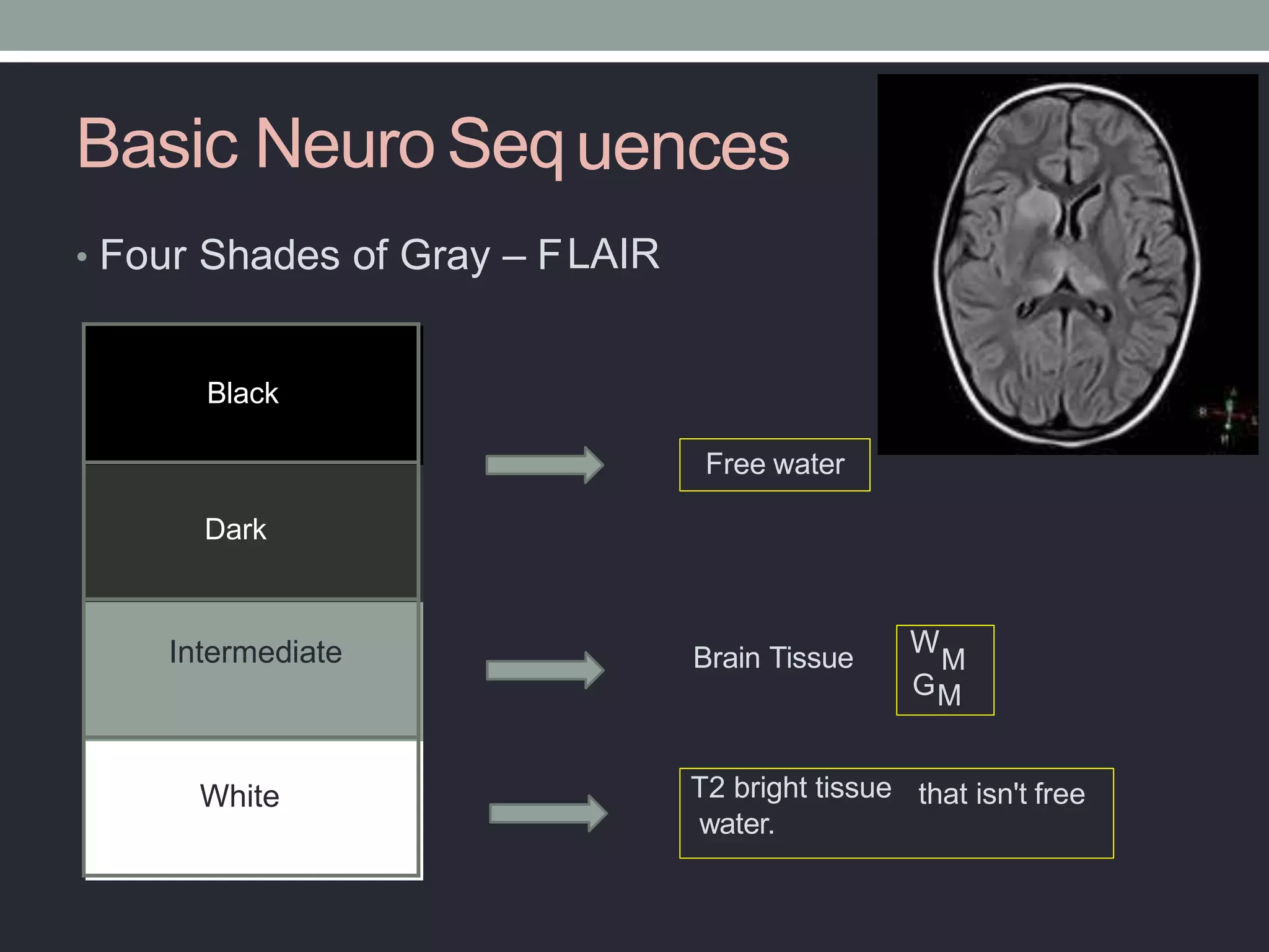 MRI basics - How to read and understand MRI sequences | PPTX