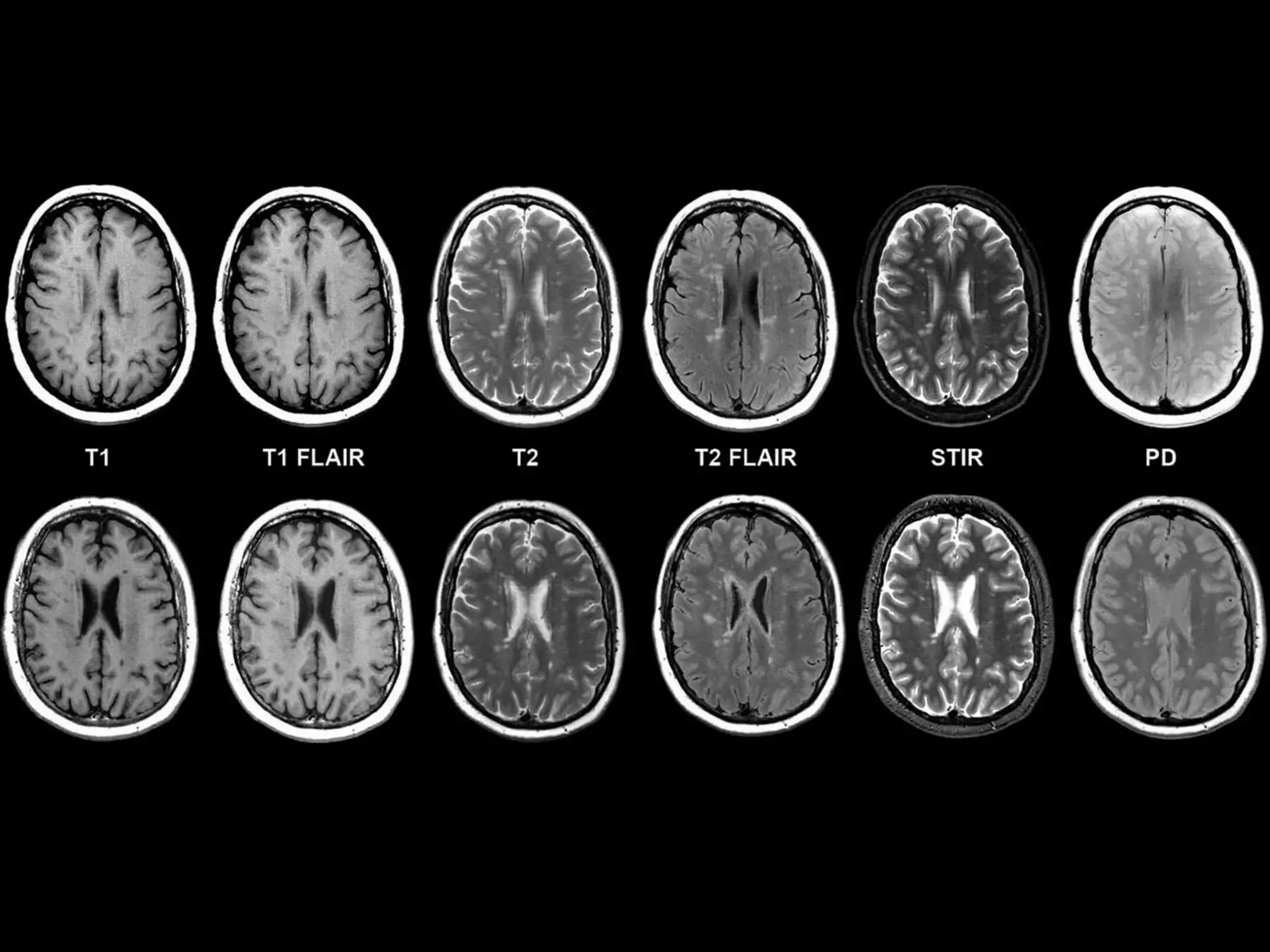 MRI basics - How to read and understand MRI sequences | PPTX