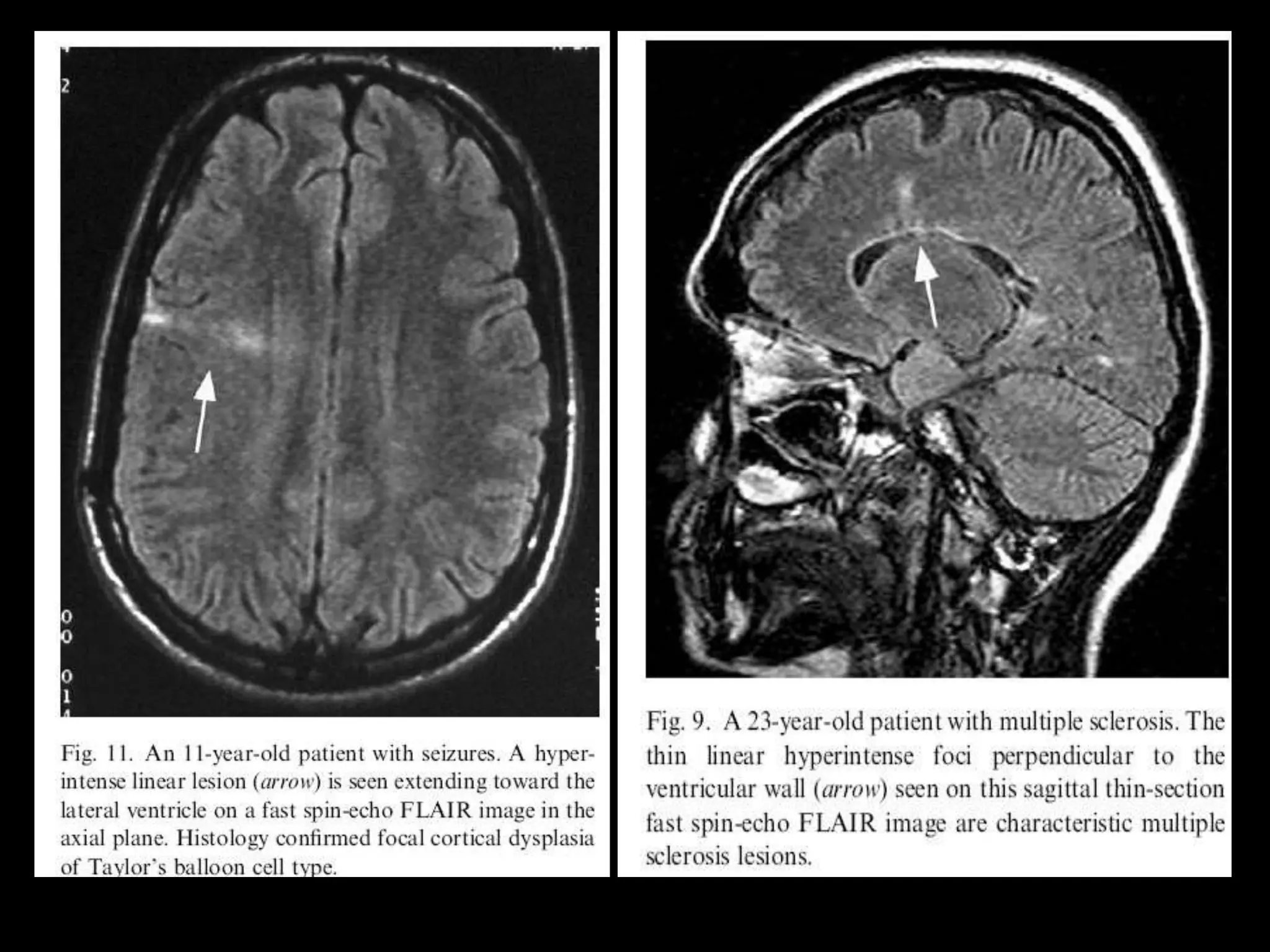 MRI basics - How to read and understand MRI sequences | PPTX