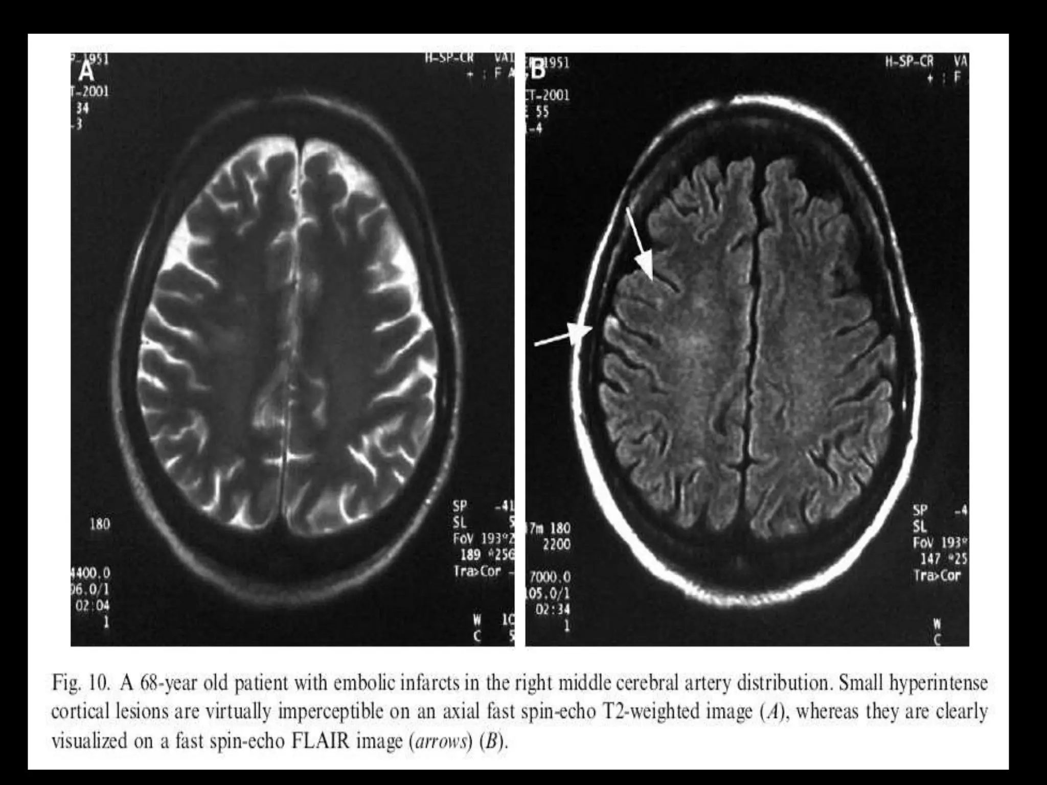 MRI basics - How to read and understand MRI sequences | PPTX