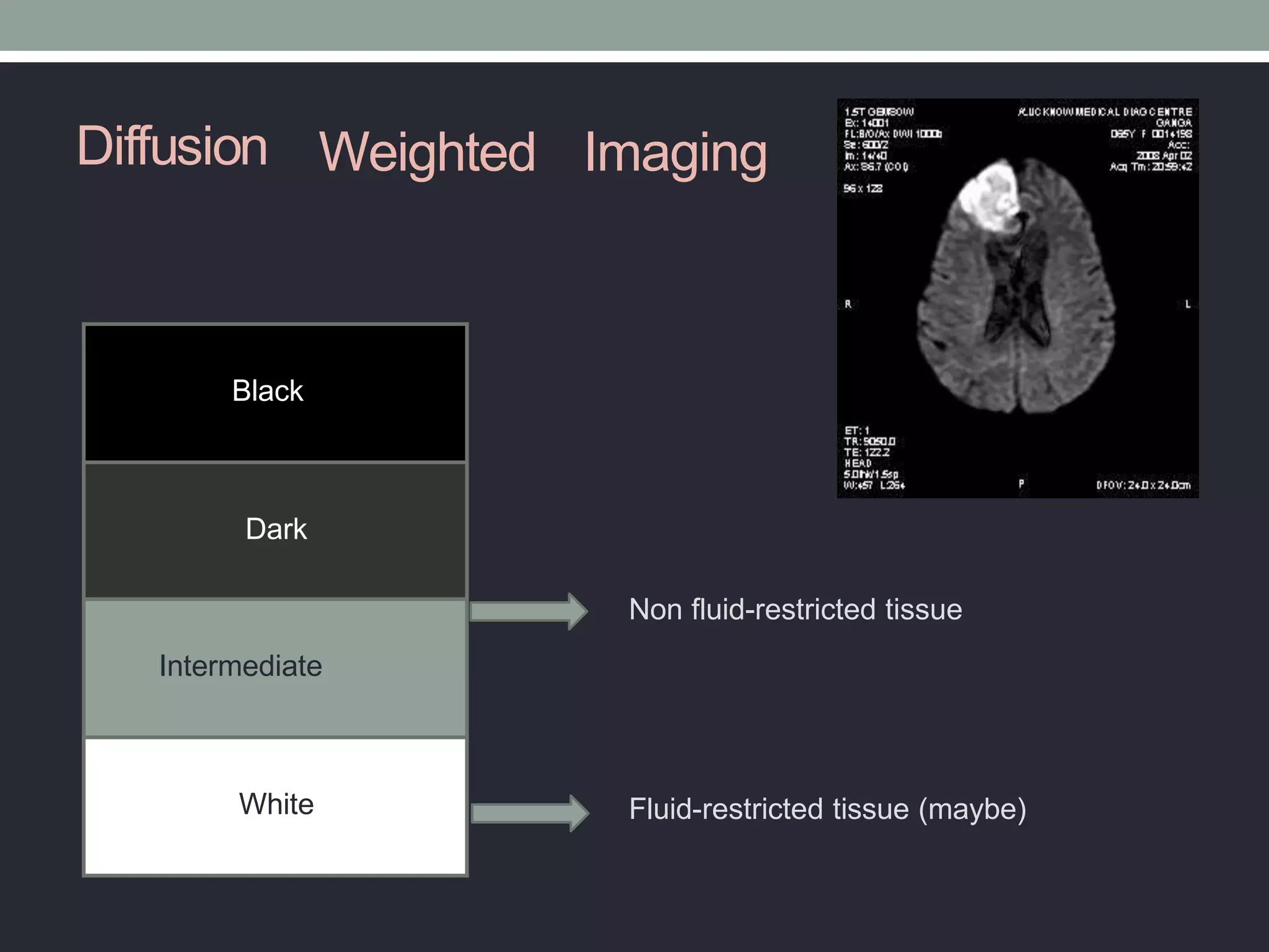 MRI basics - How to read and understand MRI sequences | PPTX