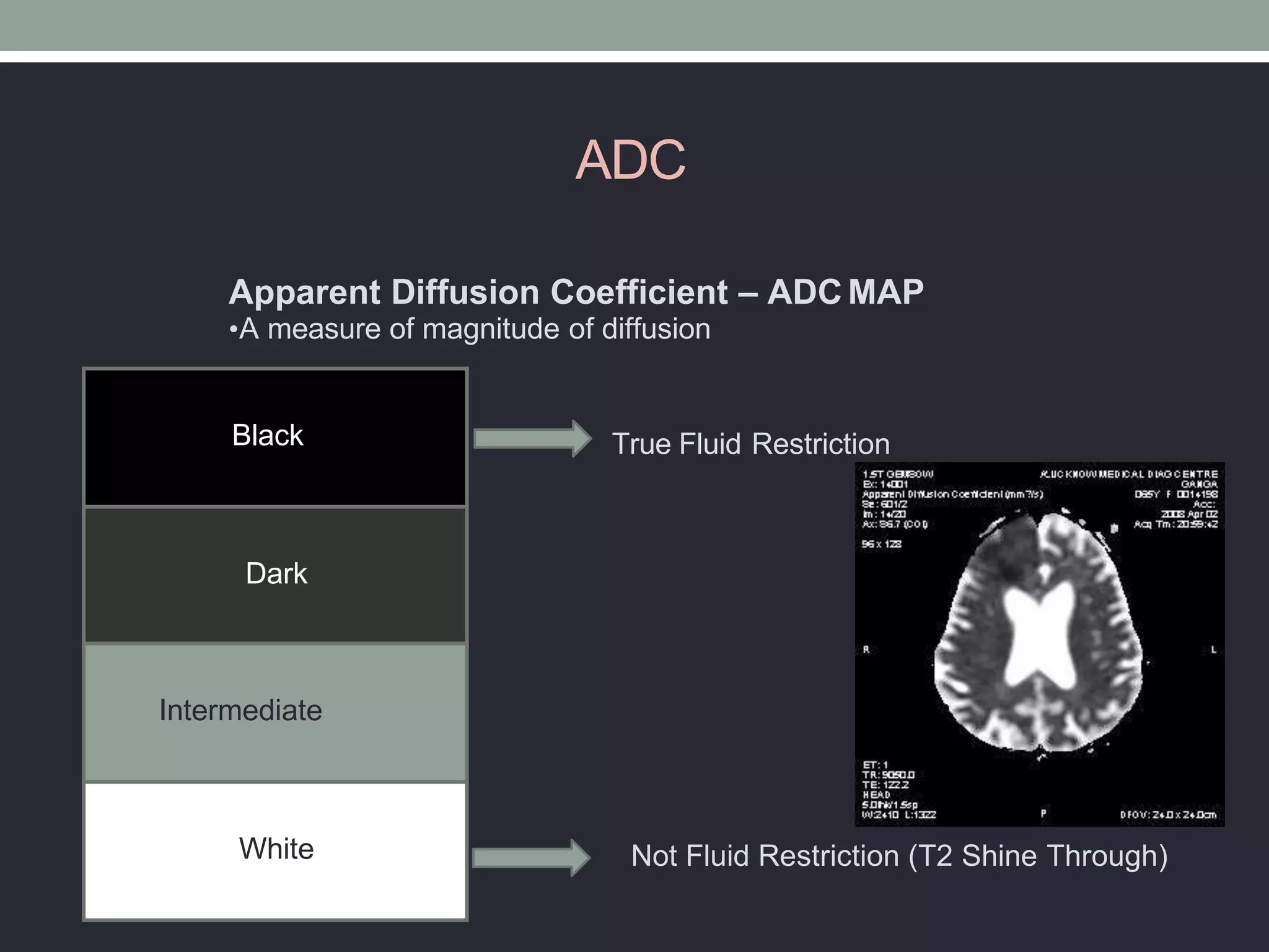 MRI basics - How to read and understand MRI sequences | PPTX
