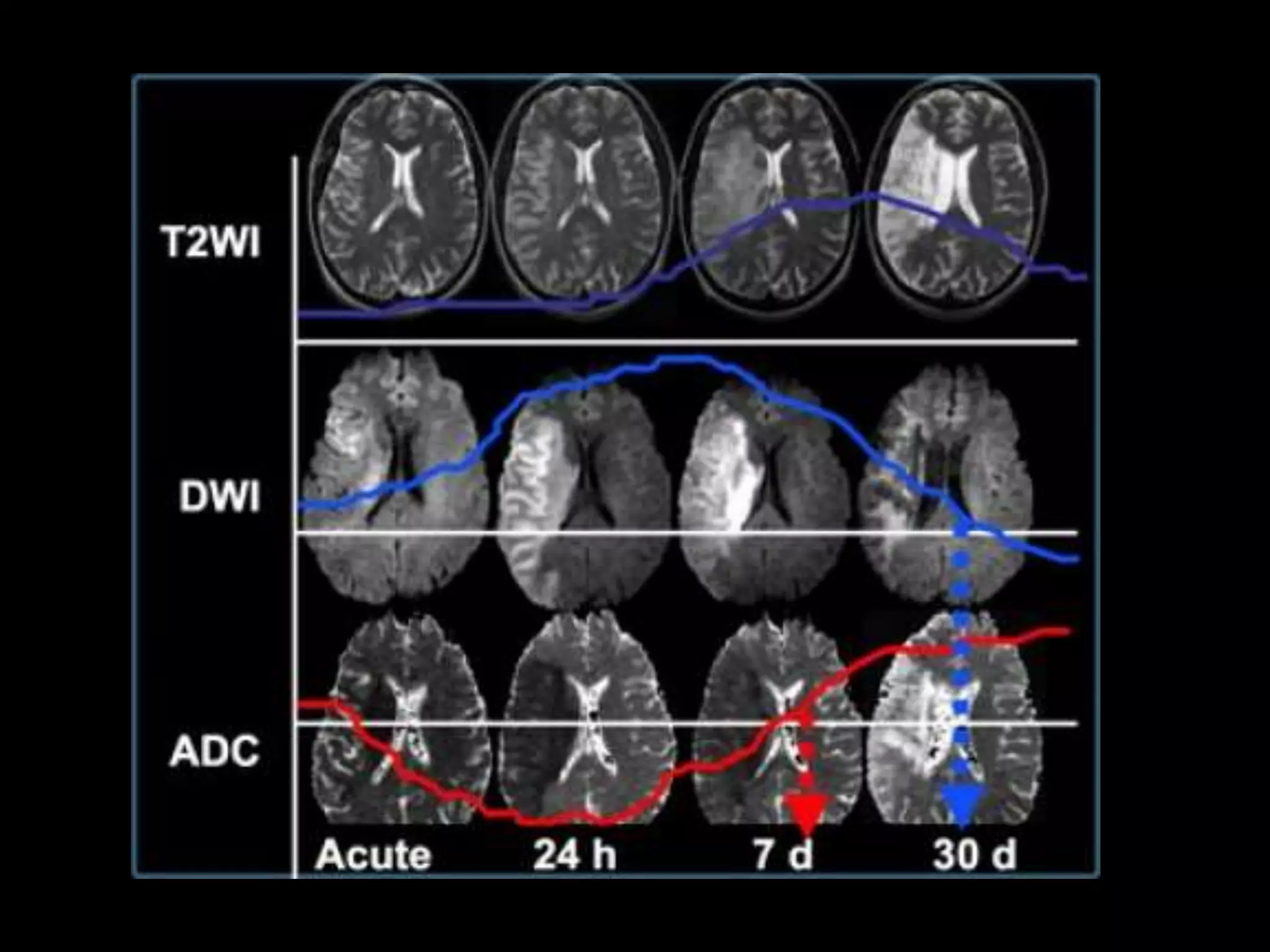 MRI basics - How to read and understand MRI sequences | PPTX