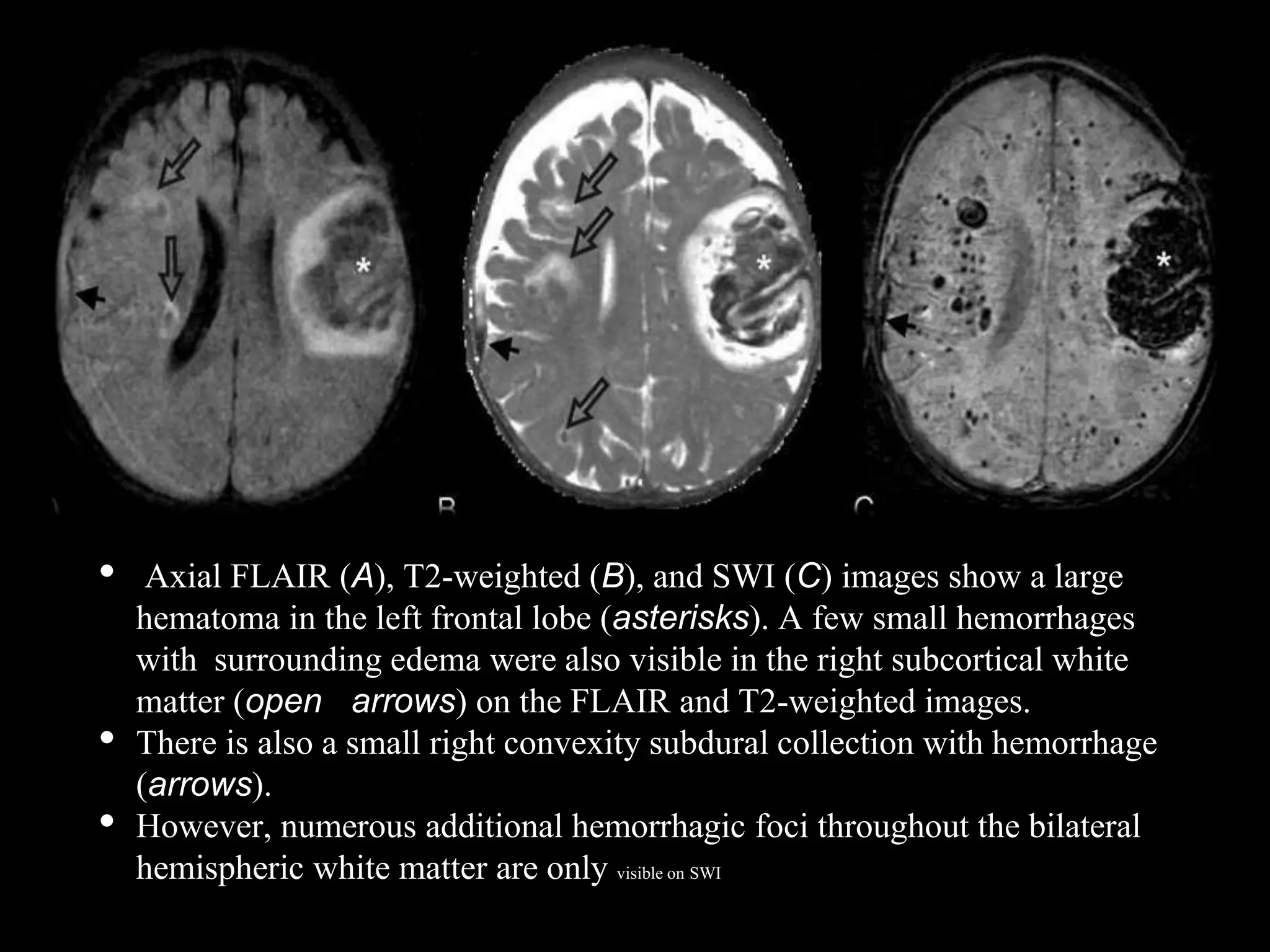 MRI basics - How to read and understand MRI sequences | PPTX