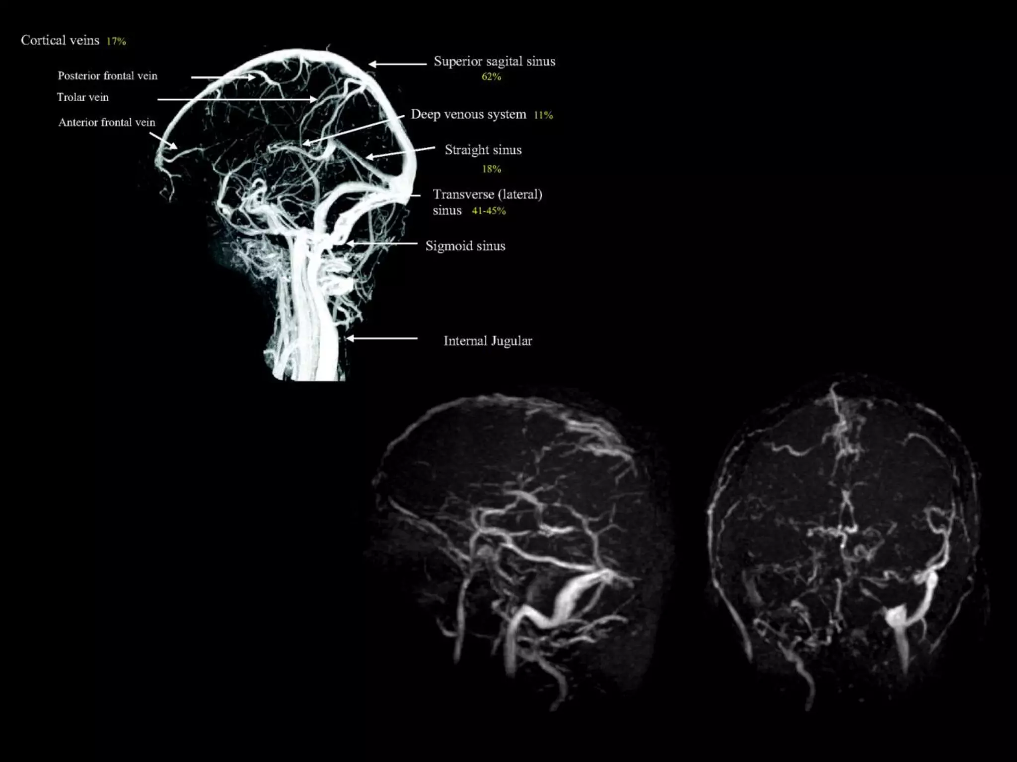 MRI basics - How to read and understand MRI sequences | PPTX