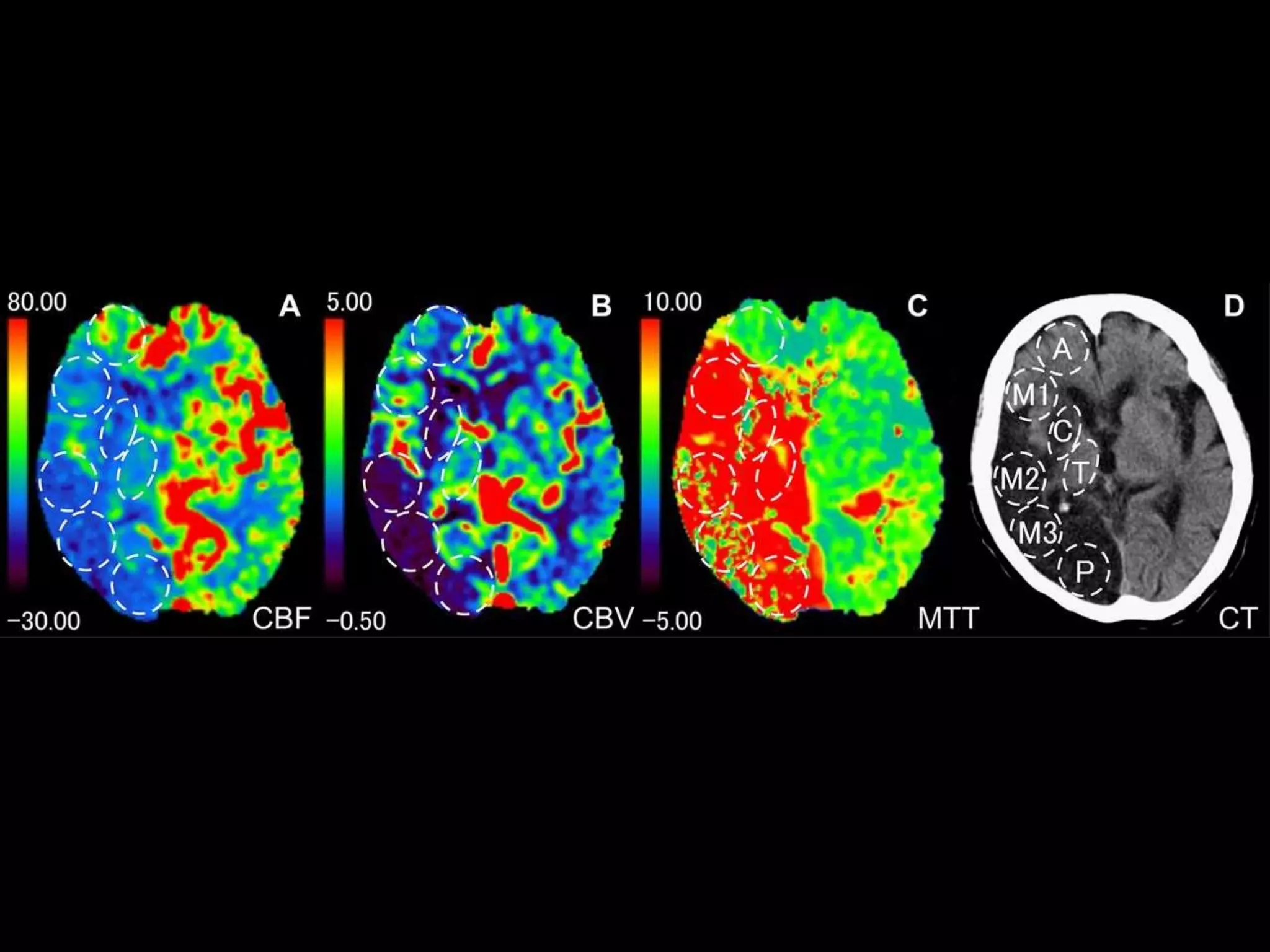 MRI basics - How to read and understand MRI sequences | PPTX