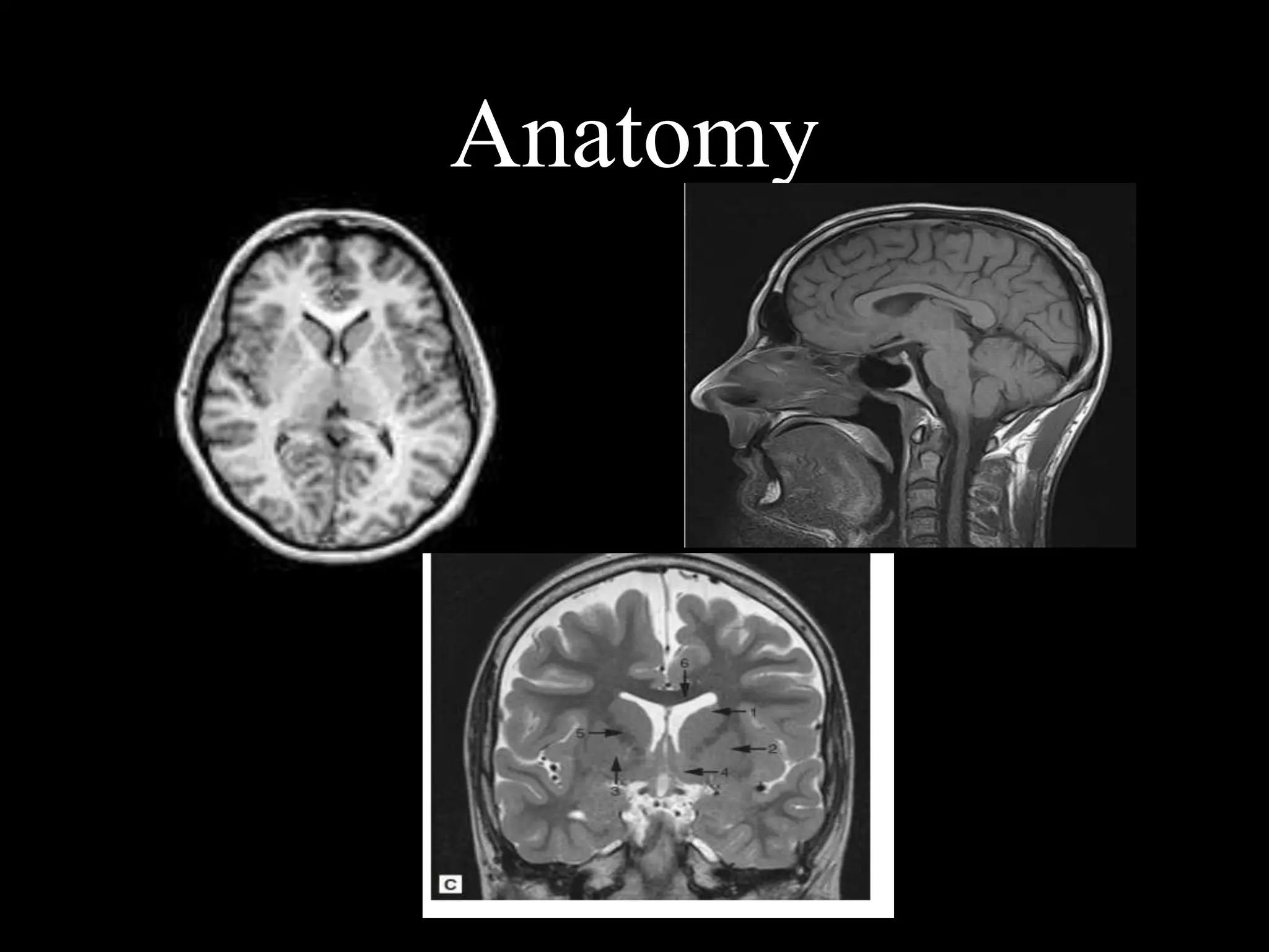 MRI basics - How to read and understand MRI sequences | PPTX