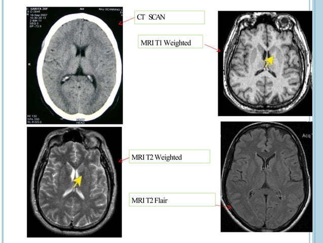 MRI basics - How to read and understand MRI sequences | PPTX