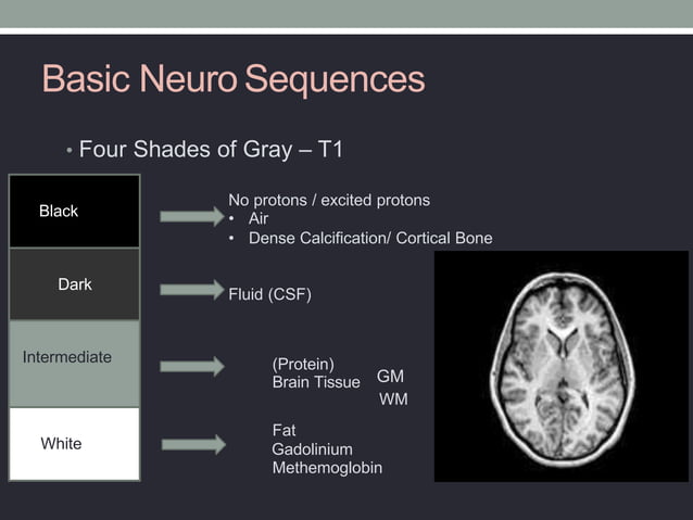 MRI basics - How to read and understand MRI sequences | PPTX