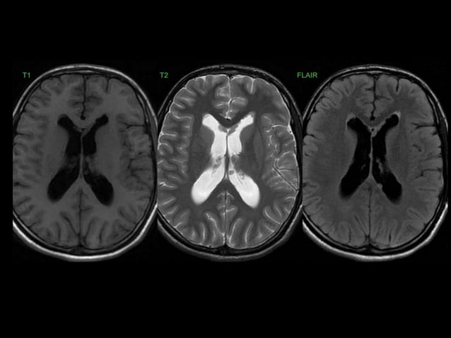 MRI basics - How to read and understand MRI sequences | PPTX