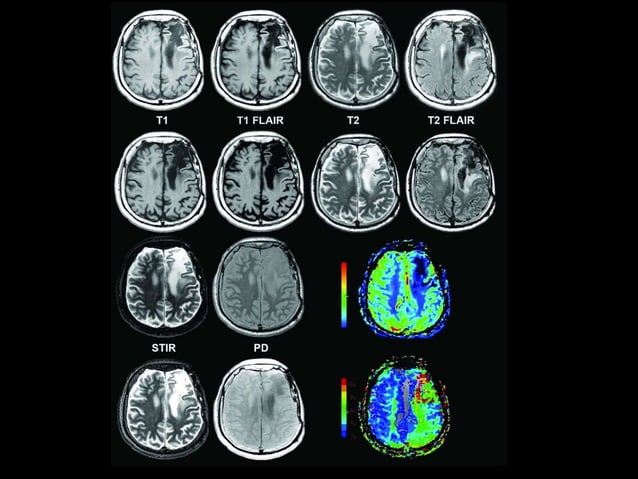 MRI basics - How to read and understand MRI sequences | PPTX