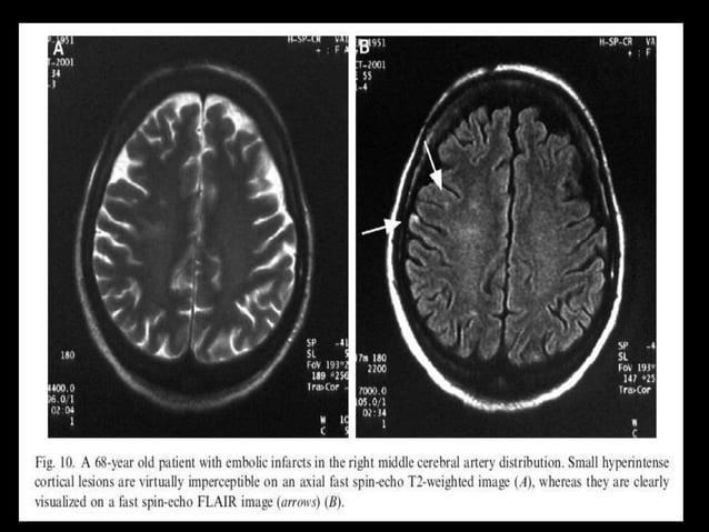 MRI basics - How to read and understand MRI sequences | PPTX