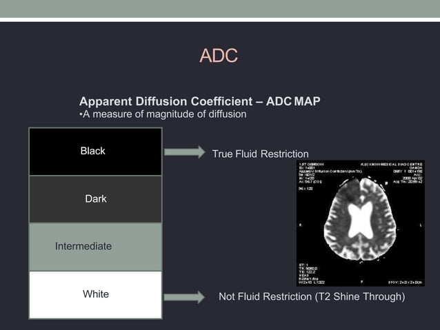 MRI basics - How to read and understand MRI sequences | PPTX