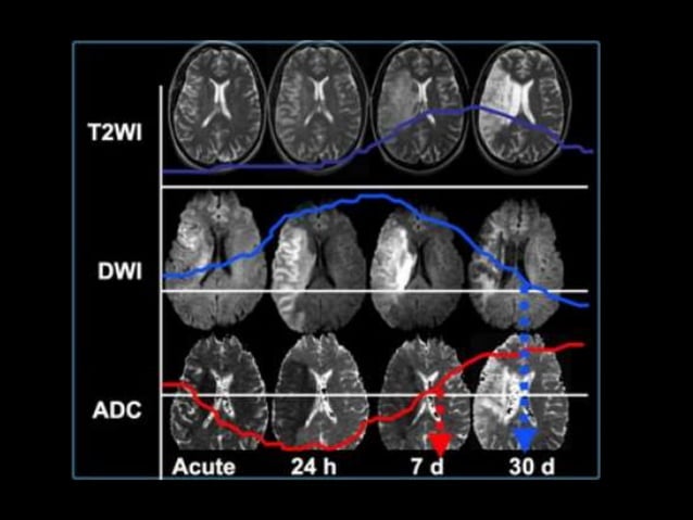 MRI basics - How to read and understand MRI sequences | PPTX
