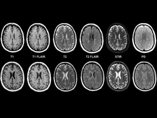 MRI basics - How to read and understand MRI sequences | PPT