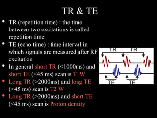 MRI basics - How to read and understand MRI sequences | PPT