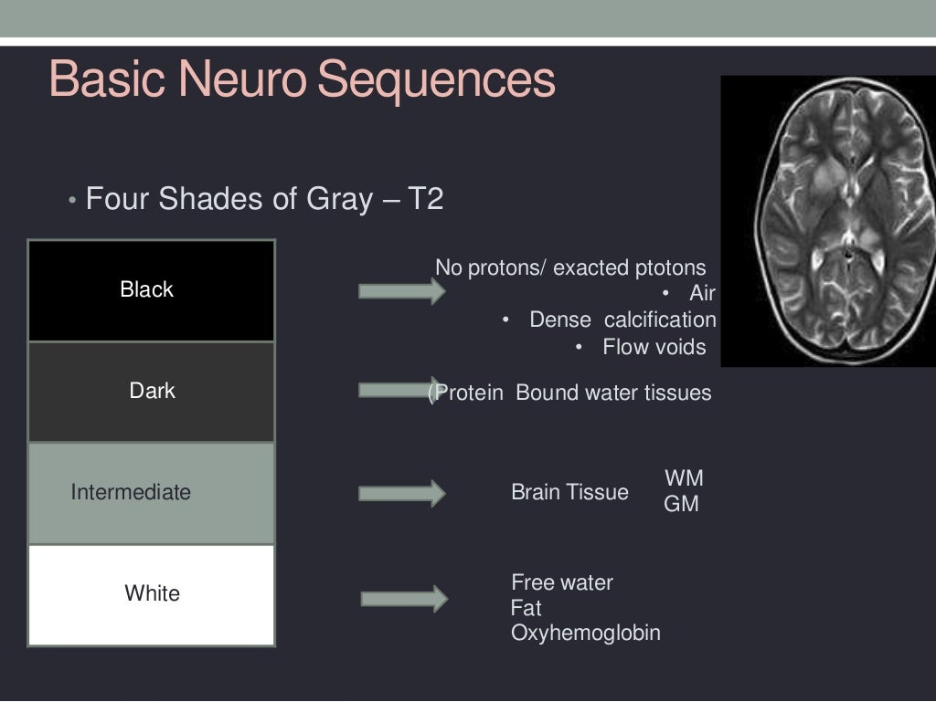 MRI basics - How to read and understand MRI sequences