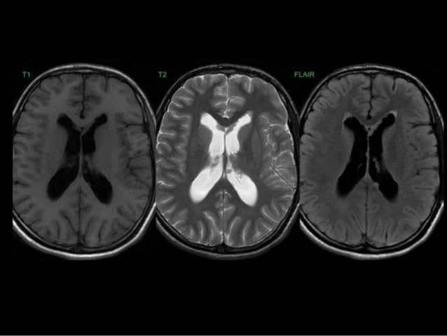 MRI basics - How to read and understand MRI sequences