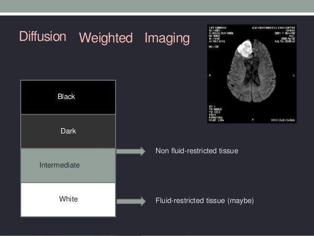 MRI basics - How to read and understand MRI sequences