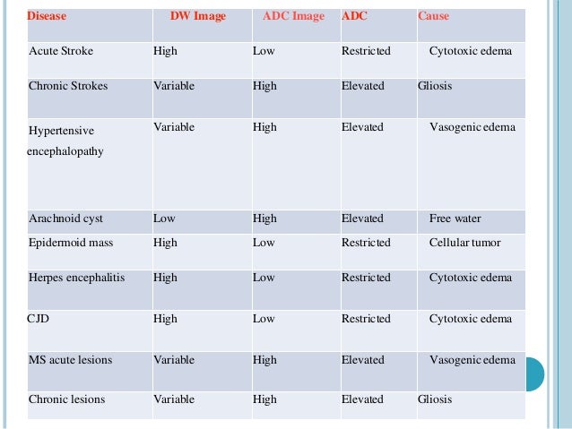MRI basics - How to read and understand MRI sequences