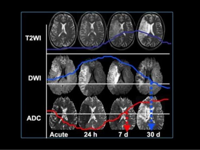 MRI basics - How to read and understand MRI sequences