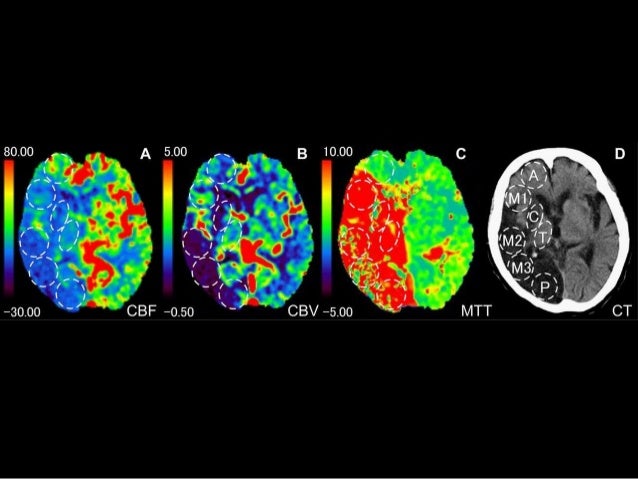 MRI basics - How to read and understand MRI sequences