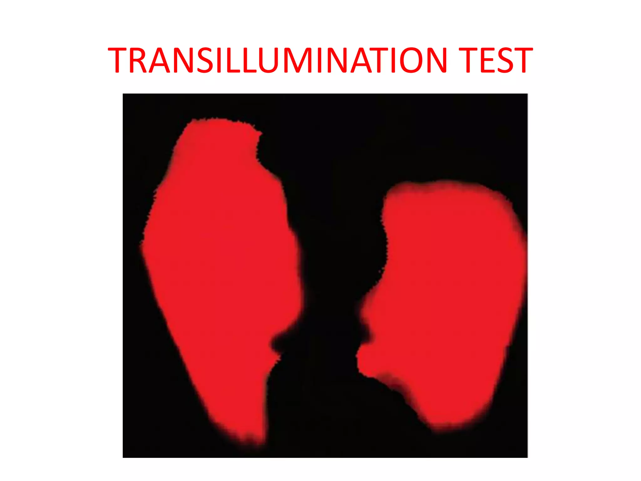ACUTE & CHRONIC RHINOSINUSITIS | PPTX