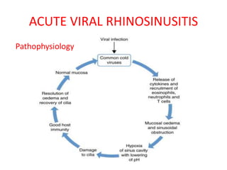 ACUTE & CHRONIC RHINOSINUSITIS | PPTX