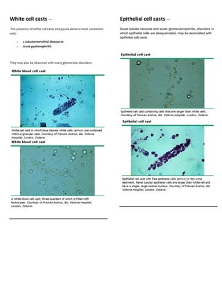 23 Urinalysis In The Diagnosis Of Renal Disease | PDF