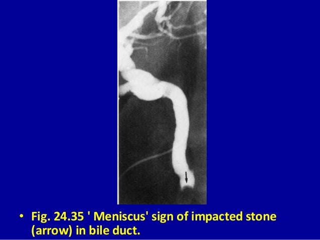 24 DAVID SUTTON PICTURES THE BILIARY TRACT