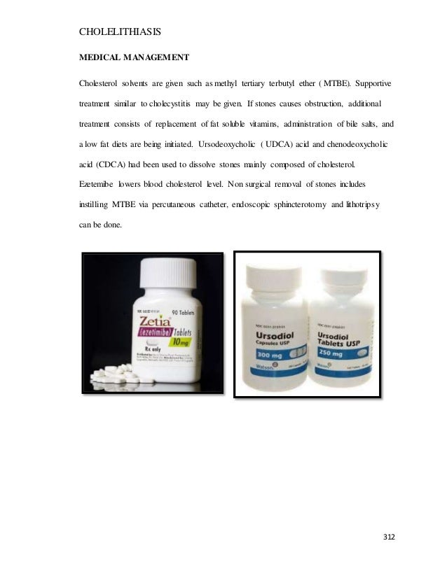 Cholelithiasis NCM 103