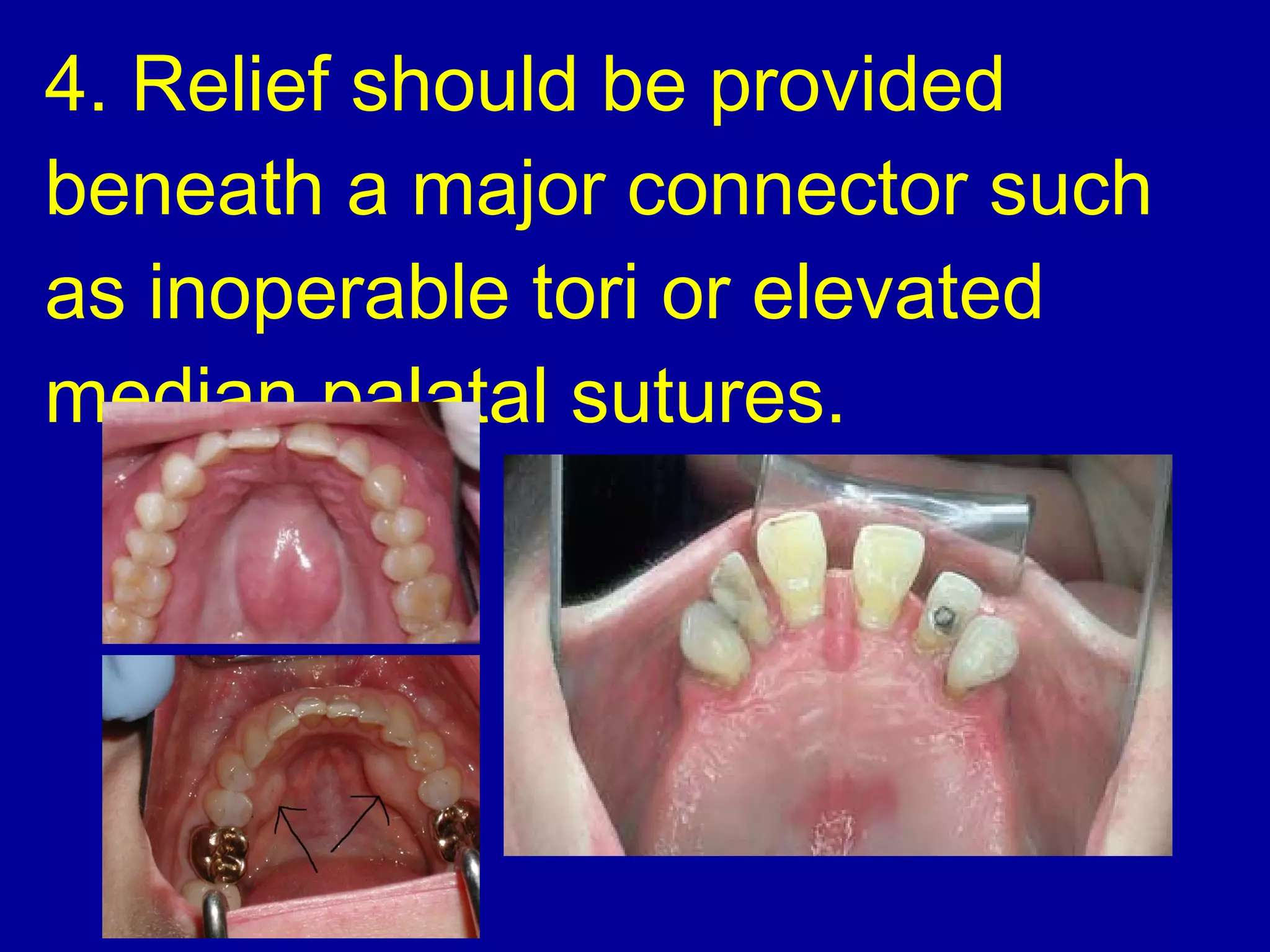 24. major connectors | PPT