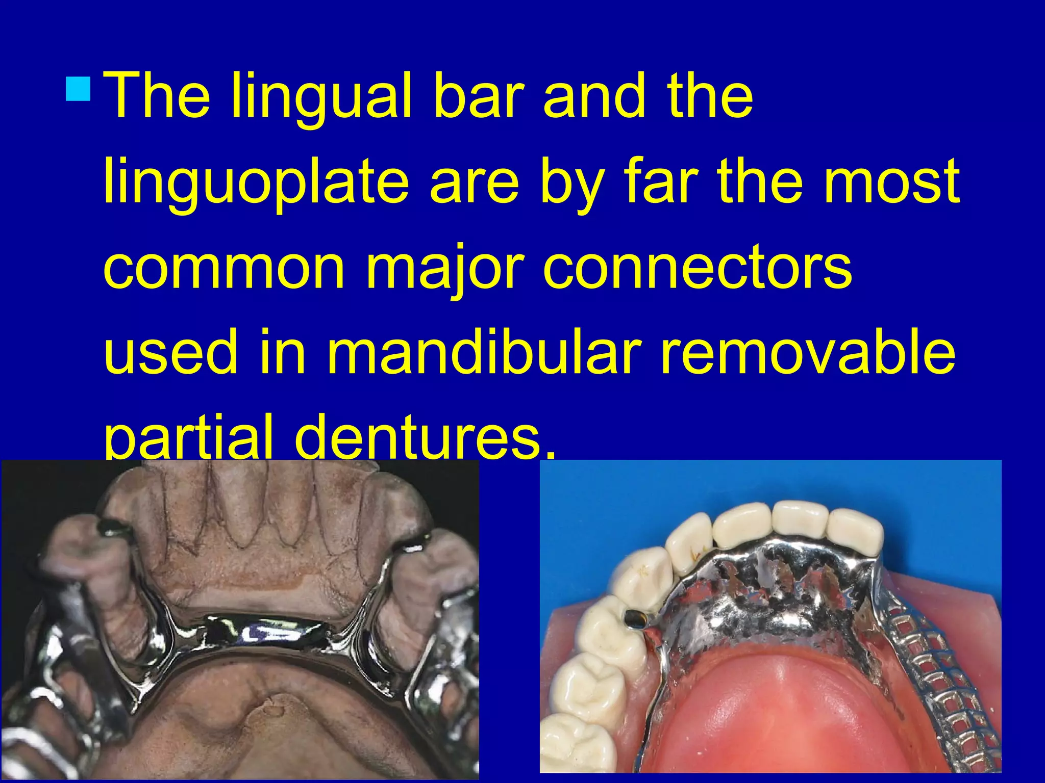 24. major connectors | PPT