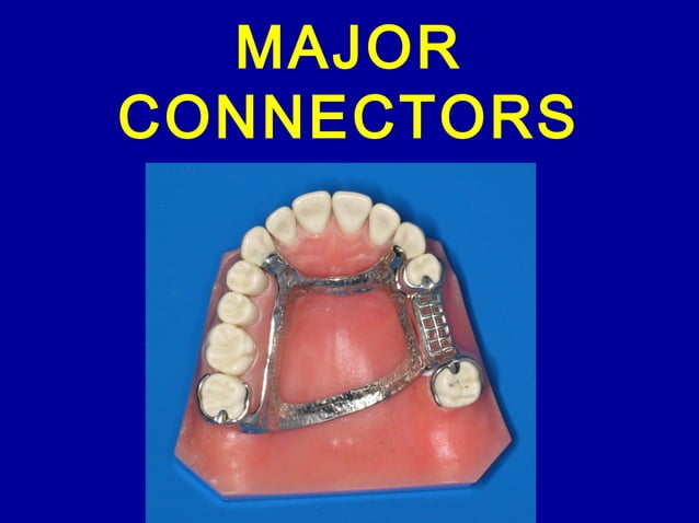 24. major connectors | PPT | Dental Health | Diseases and Conditions