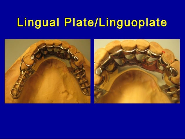 24. major connectors
