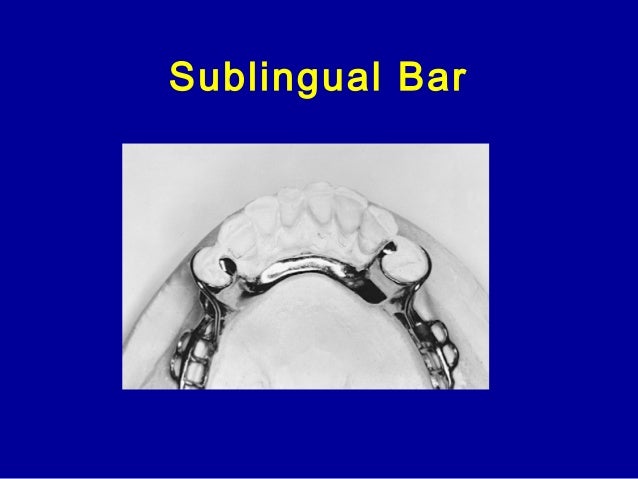 24. major connectors