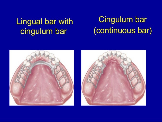 24. major connectors