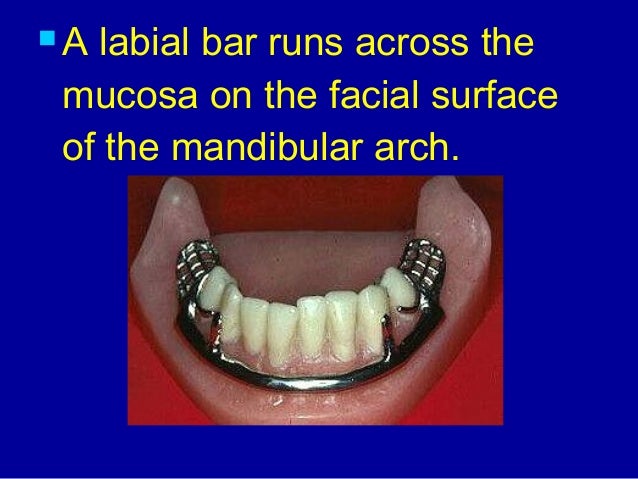 24. major connectors