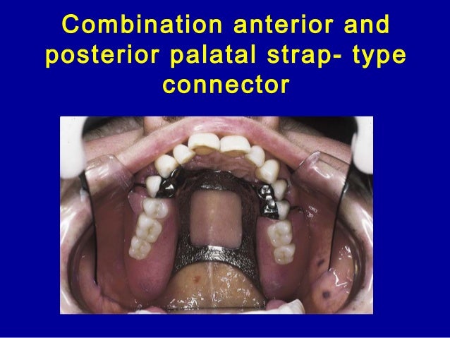 24. major connectors