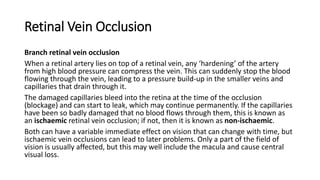 24. Retinal Vein Occlusion | PPTX