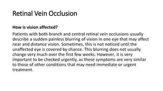 24. Retinal Vein Occlusion | PPTX