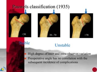 femoral neck and trochanteric fracture | PPT