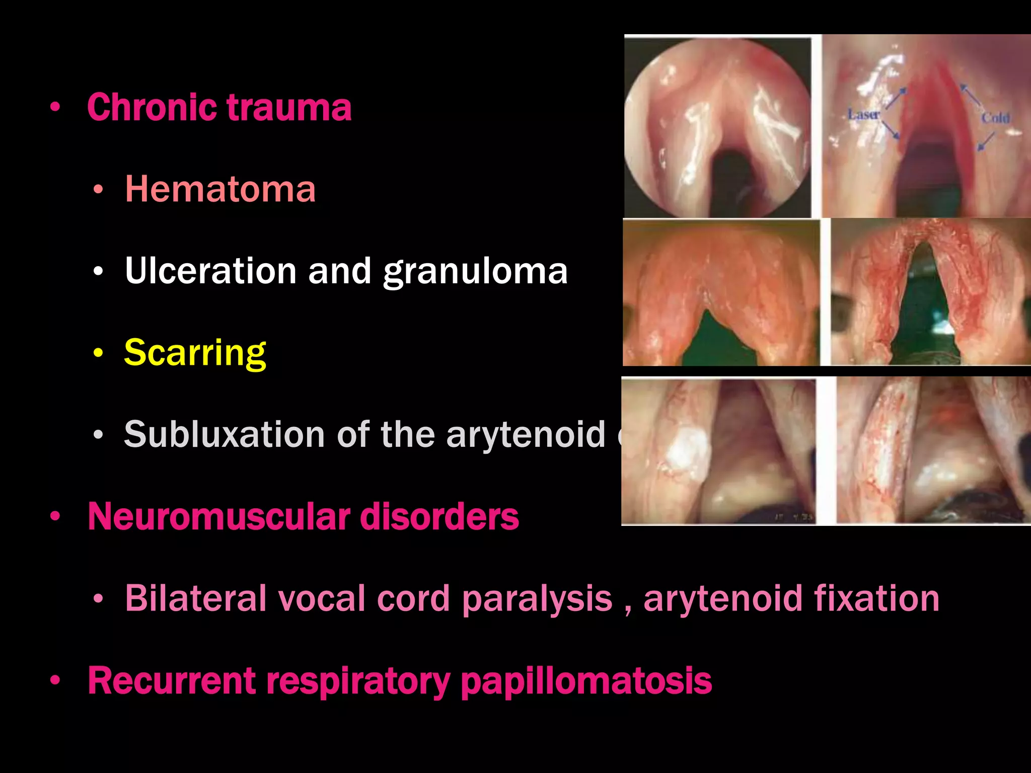 LASERs in ent | PPTX