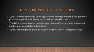 Facial Fractures I | PPTX