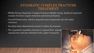 Facial Fractures I | PPTX