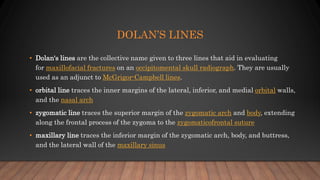 Facial Fractures I | PPTX