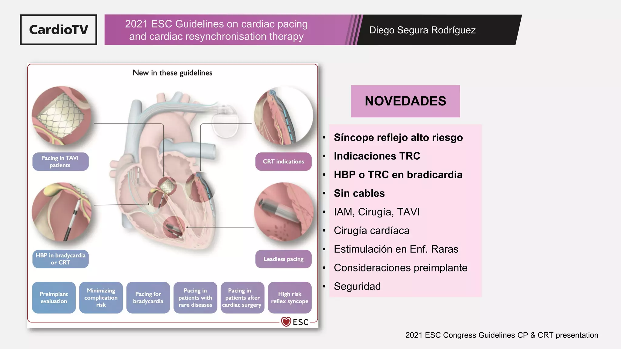 2021 ESC Guidelines on cardiac pacing and cardiac resynchronisation ...