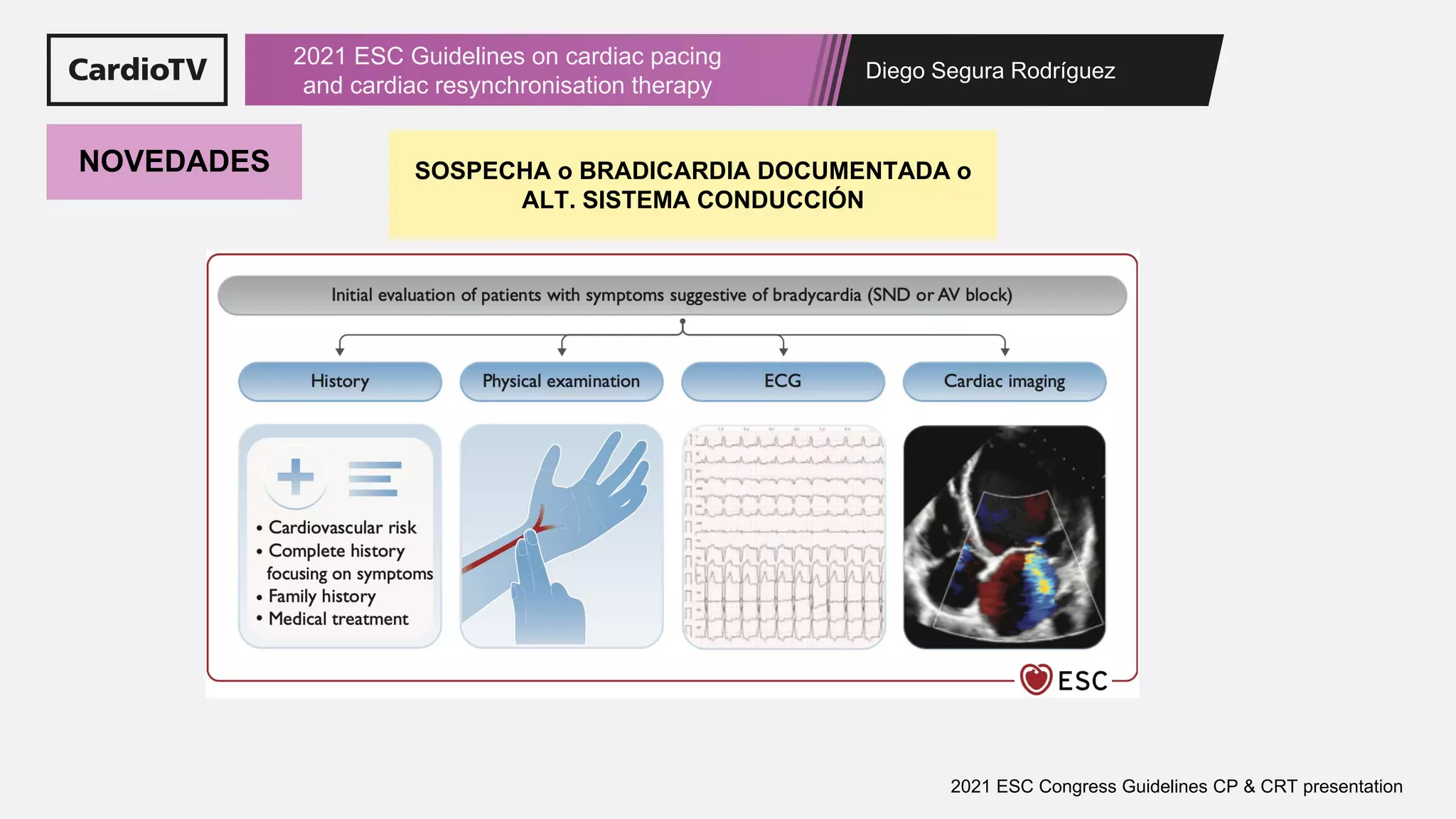 2021 ESC Guidelines on cardiac pacing and cardiac resynchronisation ...