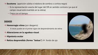 24.Desprendimiento de retina.pptx