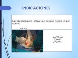 CESAREA en area de ginecologia y obstetricia | PDF